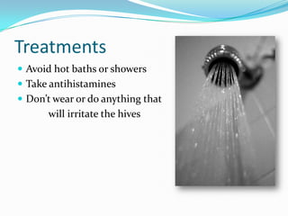Urticaria | PPTX | Allergies | Diseases and Conditions