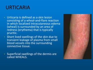 urticaria skin disease dermatology ppt.pptx