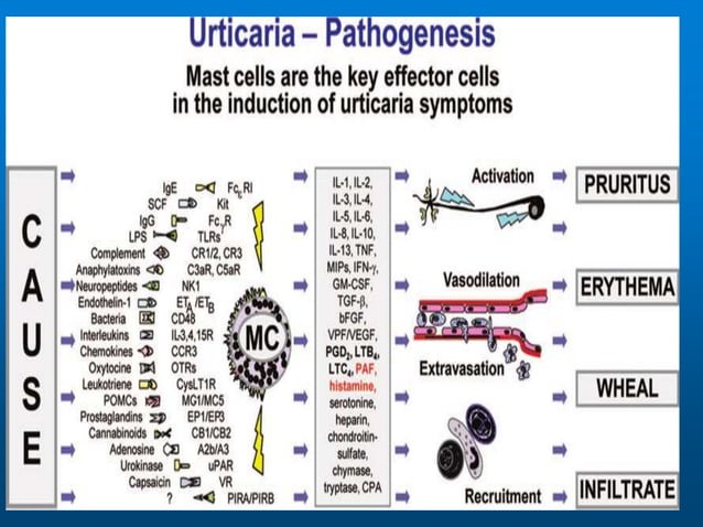 urticaria skin disease dermatology ppt.pptx