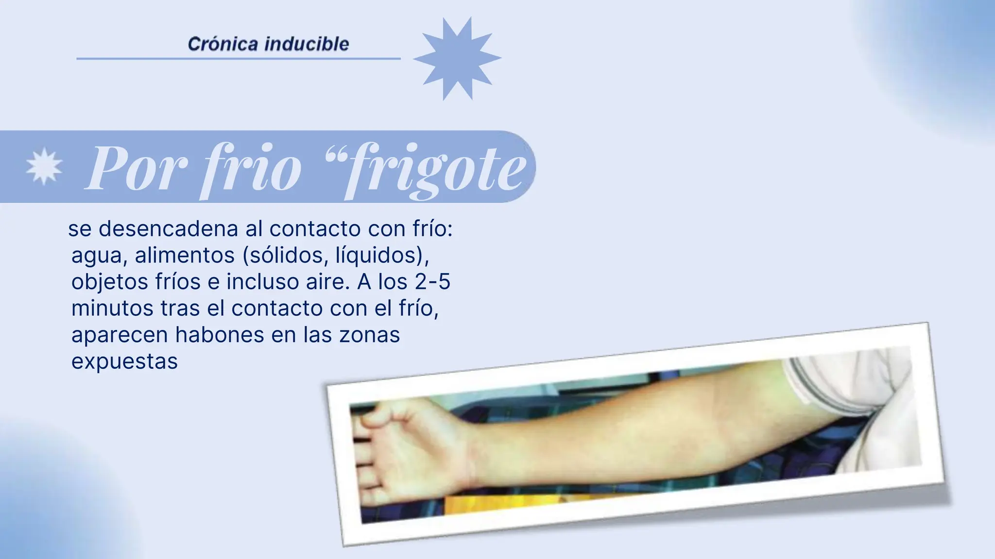 presentación urticaria y angioedema en inmunología pediátrica | PPTX