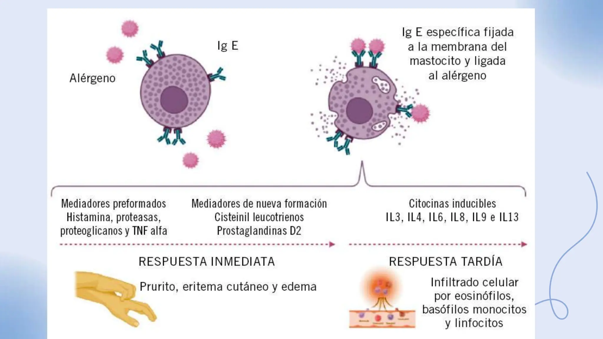 presentación urticaria y angioedema en inmunología pediátrica | PPTX