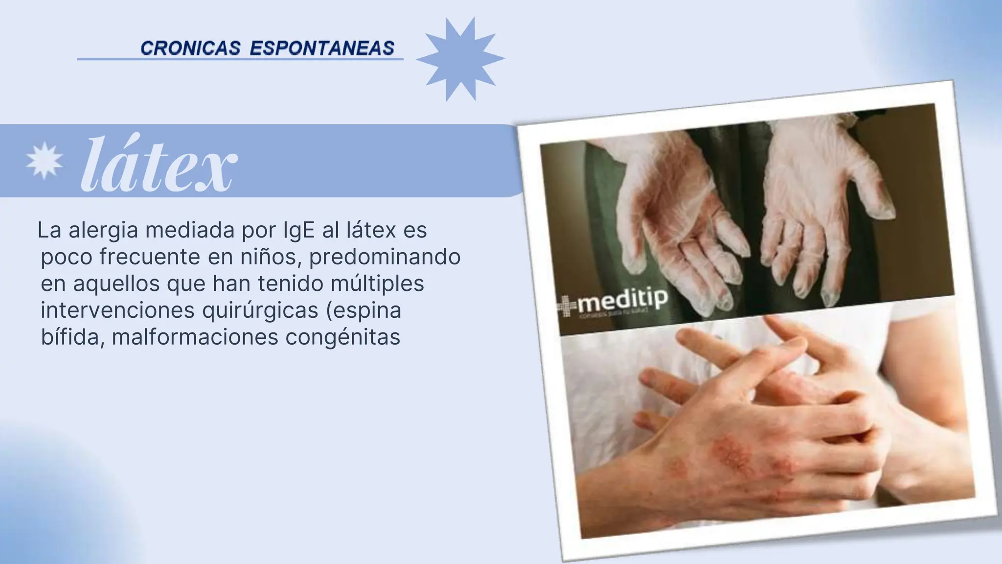 presentación urticaria y angioedema en inmunología pediátrica | PPTX