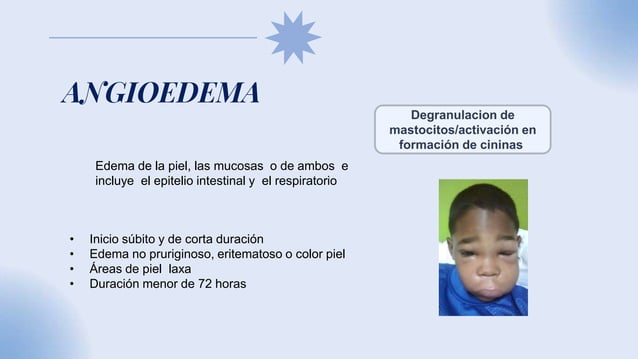 presentación urticaria y angioedema en inmunología pediátrica | PPTX