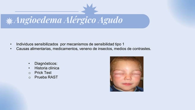presentación urticaria y angioedema en inmunología pediátrica | PPTX