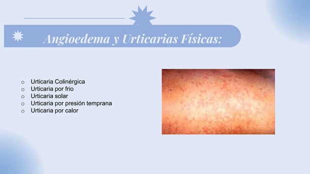 presentación urticaria y angioedema en inmunología pediátrica | PPTX