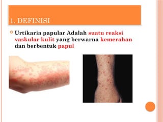Urtikaria Papular penyakit kulit 182.pptx