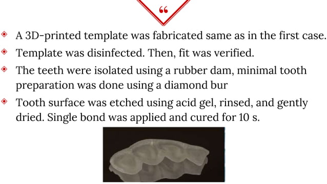 JOURNAL CLUB: “Direct resin composite restoration of maxillary central ...