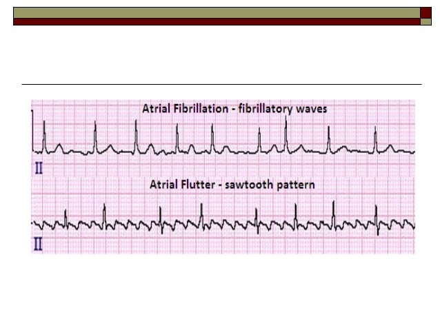 Urgentna stanja u kardiologiji