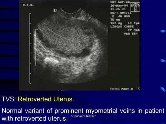 Ultrasonography of the uterus | PDF | Pregnancy | Reproductive Health
