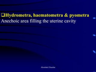 Ultrasonography of the uterus | PDF