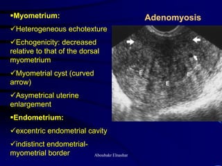 Myometrium Is Homogeneous