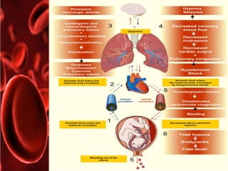 Embolism | PPTX