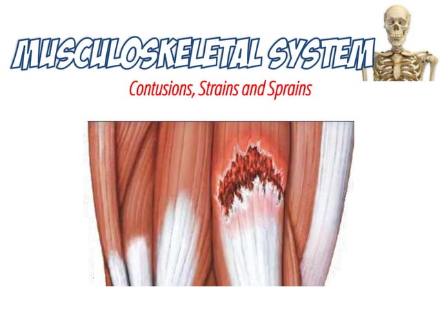 Musculoskeletal System Trauma