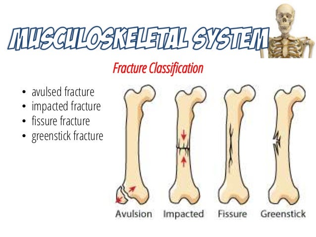 Musculoskeletal System Trauma