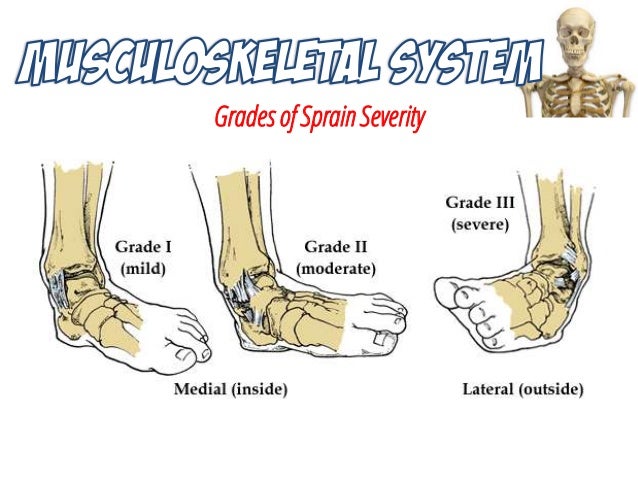 Musculoskeletal System Trauma