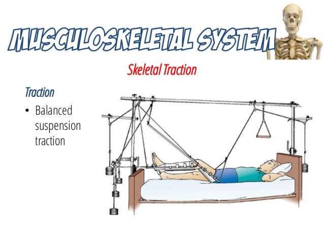 Musculoskeletal System Trauma