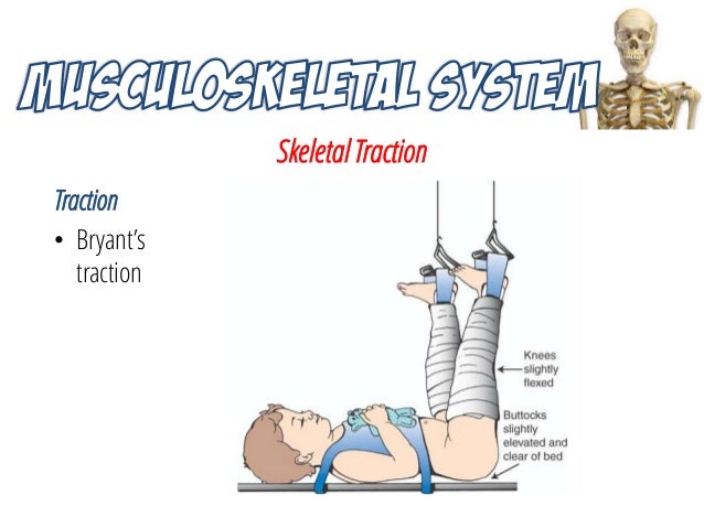 Musculoskeletal System Trauma