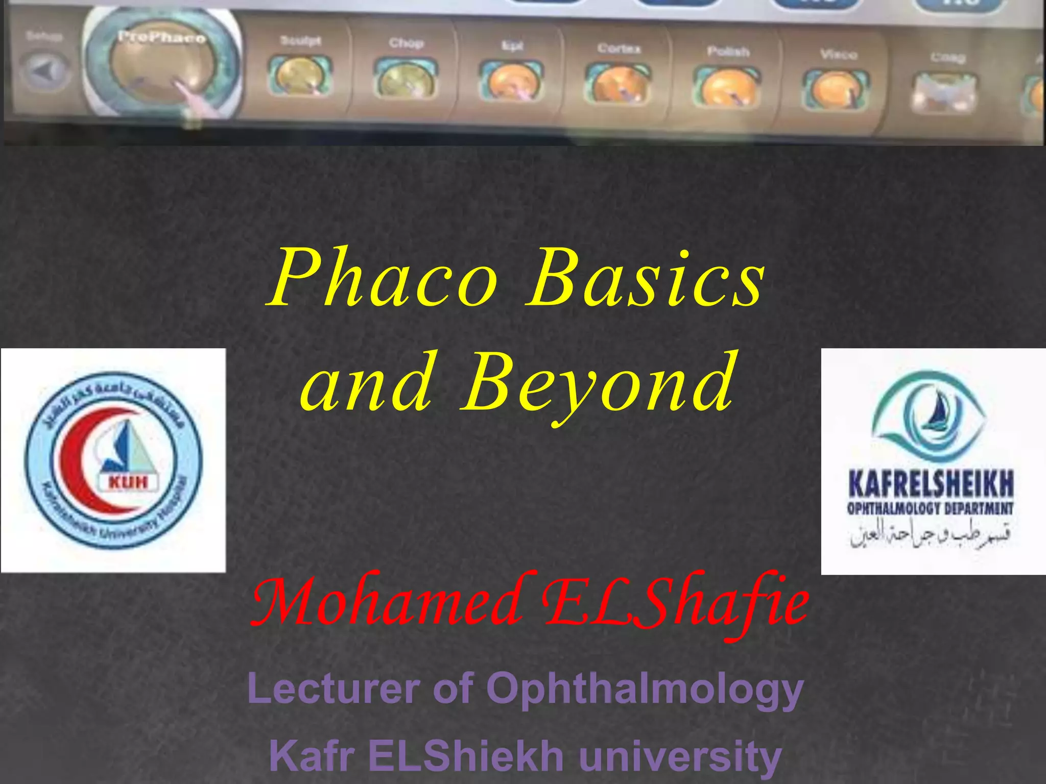 Phaco basics and beyond | PPTX