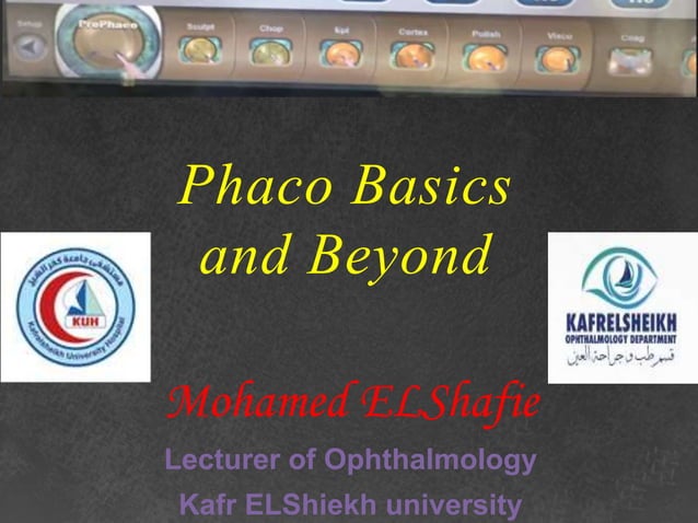 Phaco basics and beyond | PPTX | Eye and Vision Conditions | Diseases and Conditions
