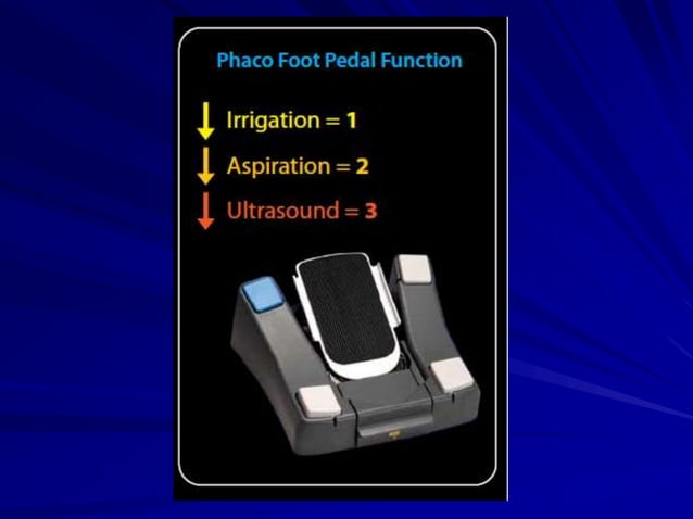 Phaco basics and beyond | PPTX | Eye and Vision Conditions | Diseases ...