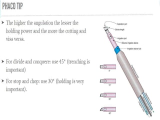 Phaco basics and beyond | PPTX