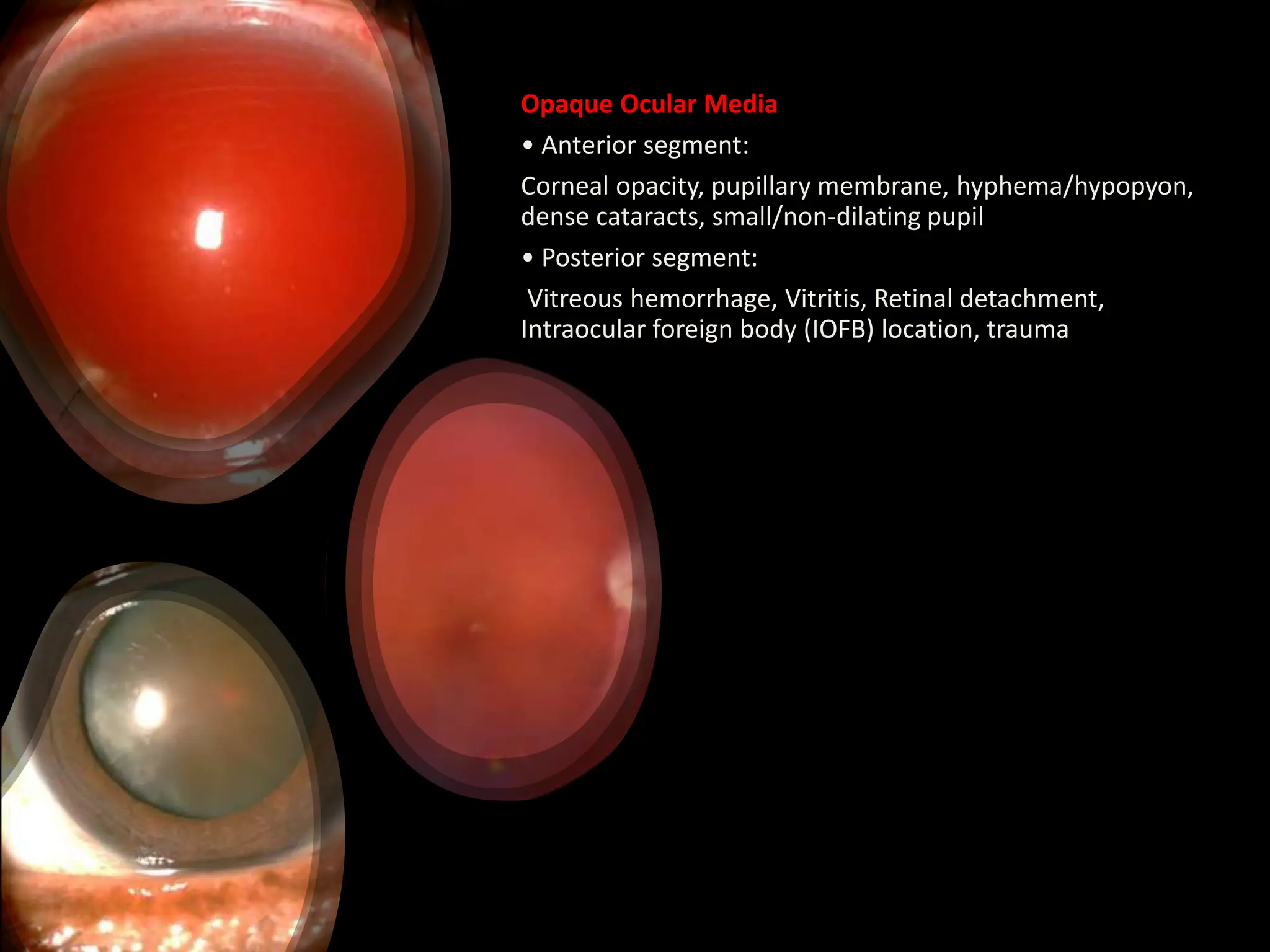 Ophthalmology Ultrasound Training Course | PPTX