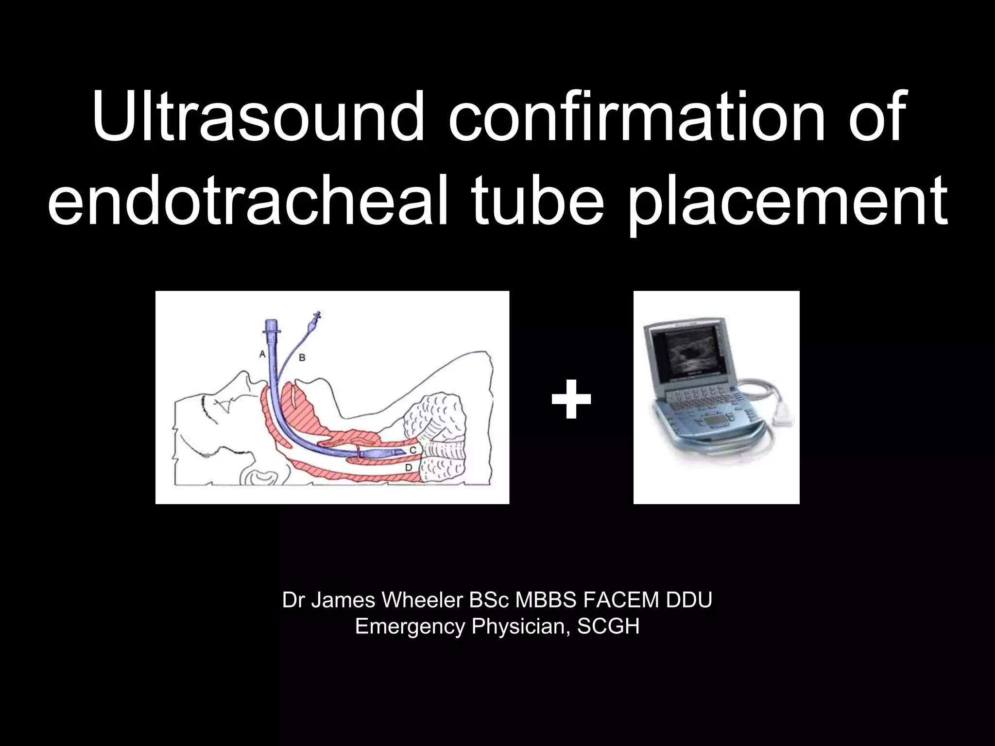 Ultrasound confirmation of ETT placement | PPT