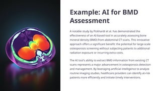 Use of Artificial Intelligence in the Management of Osteoporosis | PPTX