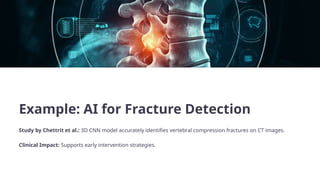 Use of Artificial Intelligence in the Management of Osteoporosis | PPTX