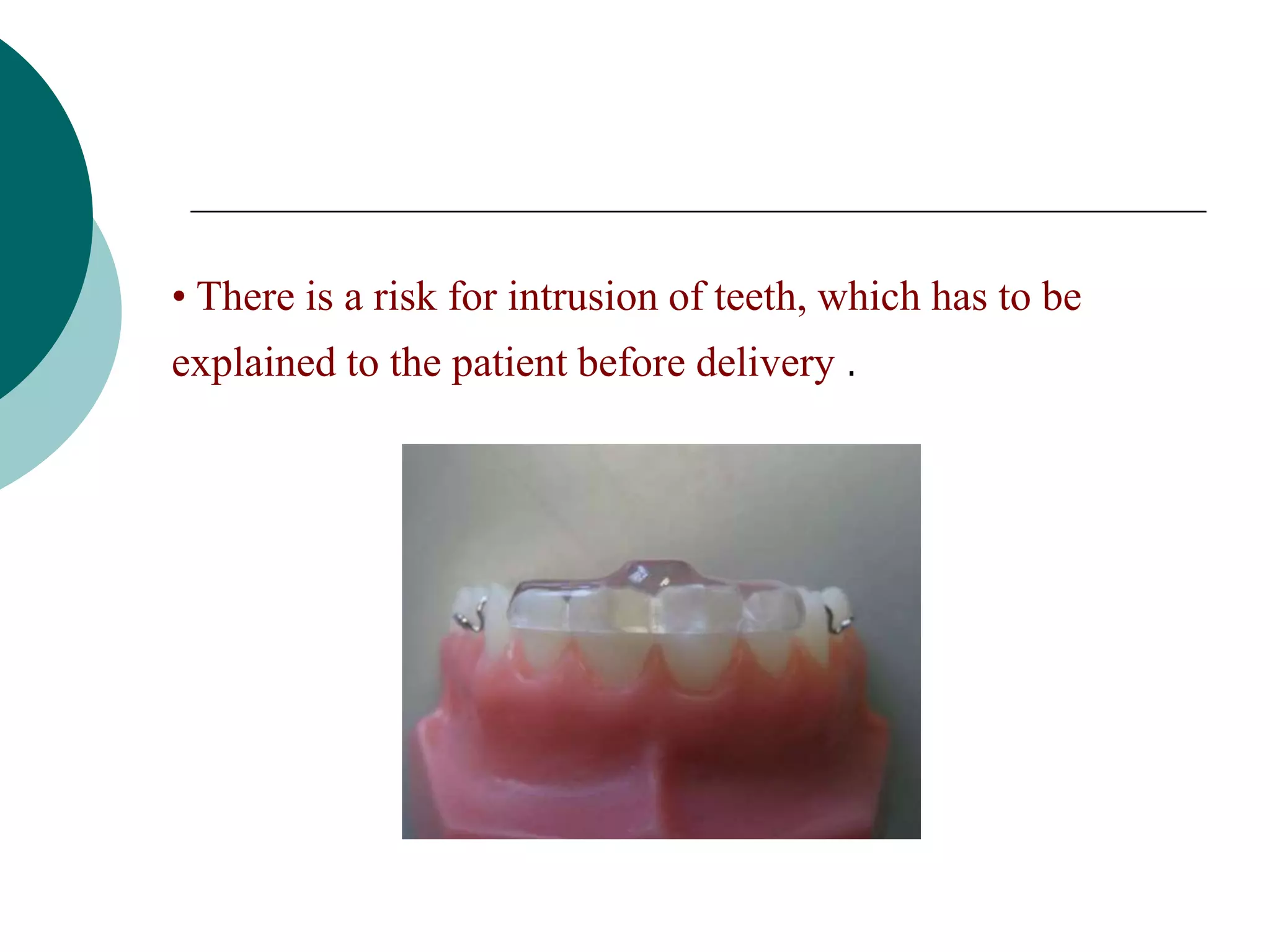 Use and abuse of bite splint. | PPT