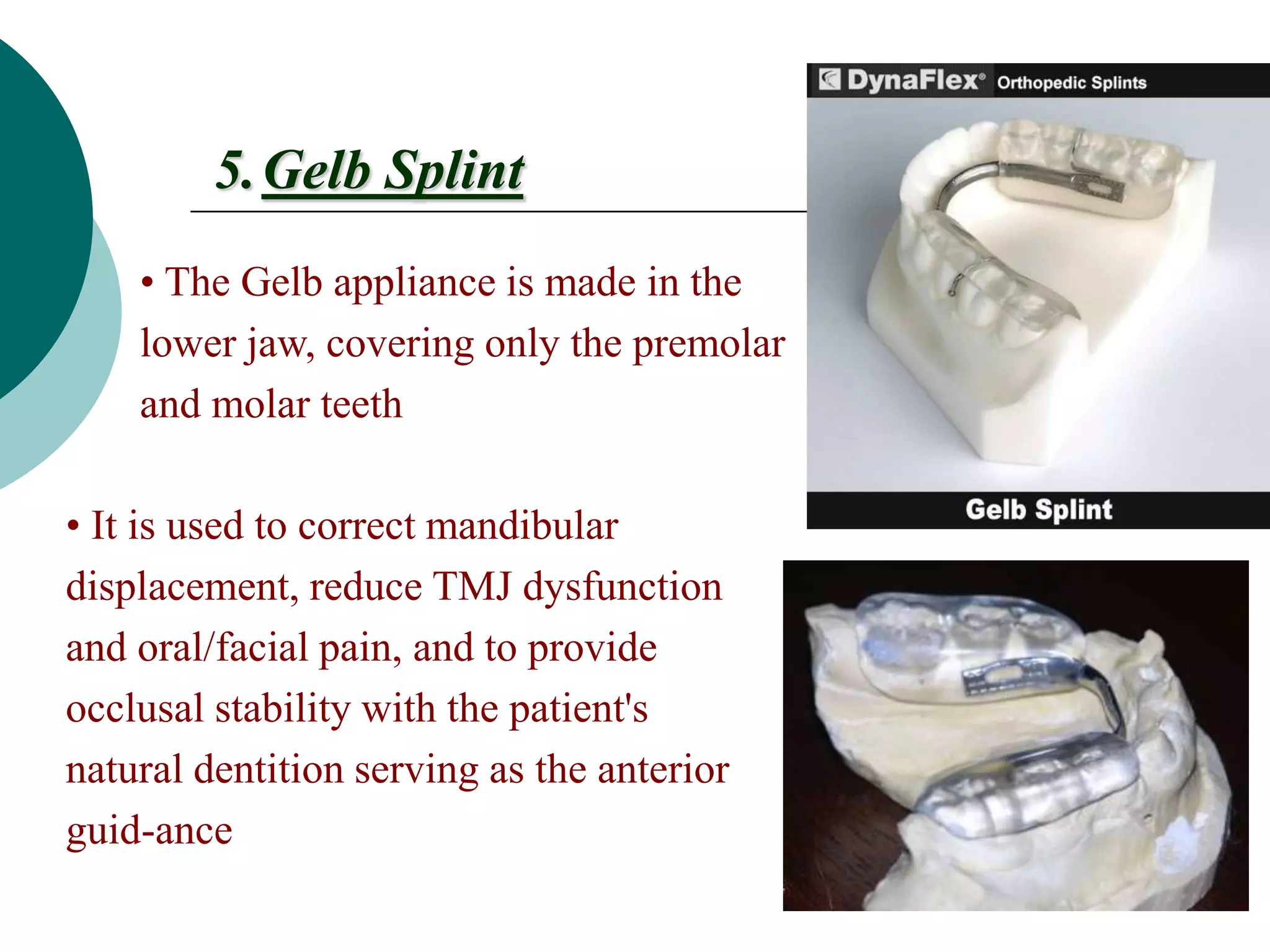 Use and abuse of bite splint. | PPT