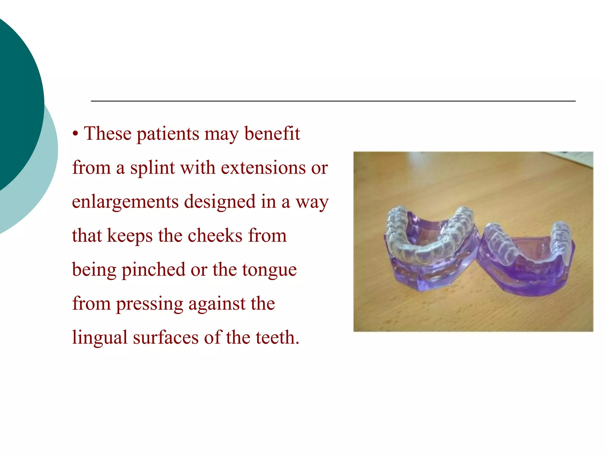 Use and abuse of bite splint. | PPT