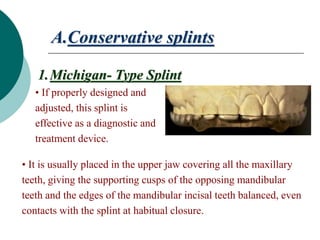 Use and abuse of bite splint. | PPT