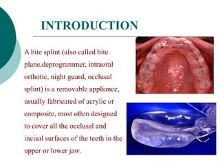 Use and abuse of bite splint. | PPT