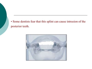 Use and abuse of bite splint. | PPT