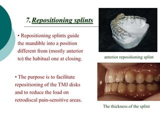 Use and abuse of bite splint. | PPT