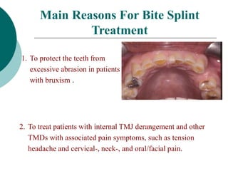 Use and abuse of bite splint. | PPT | Dental Health | Diseases and ...