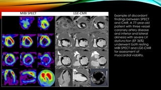 Usefulness of multimodality imaging for myocardial viability | PPT
