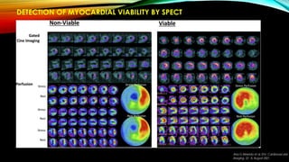 Usefulness of multimodality imaging for myocardial viability | PDF