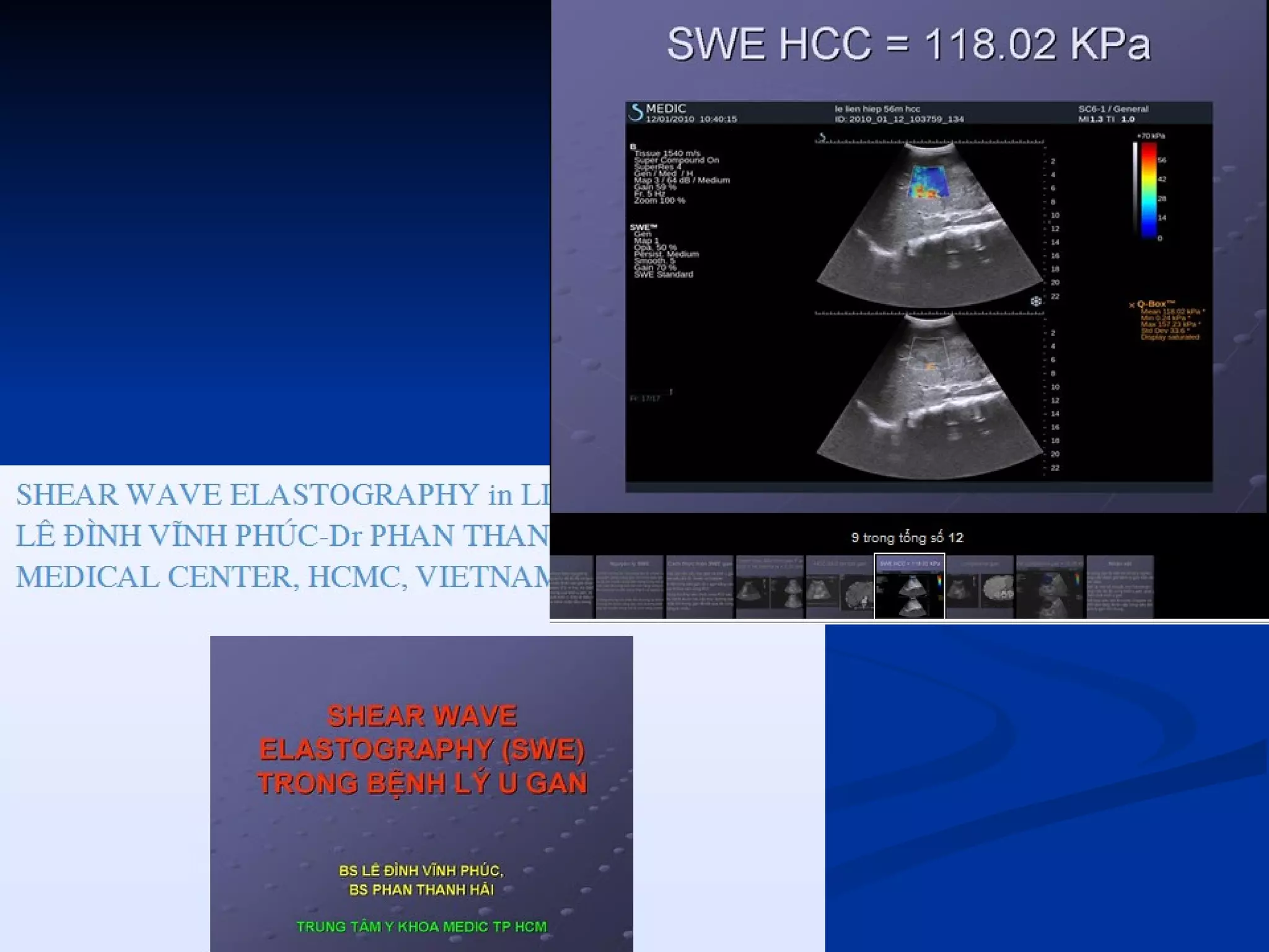Ultrasound Elastography Medic VN | PPT