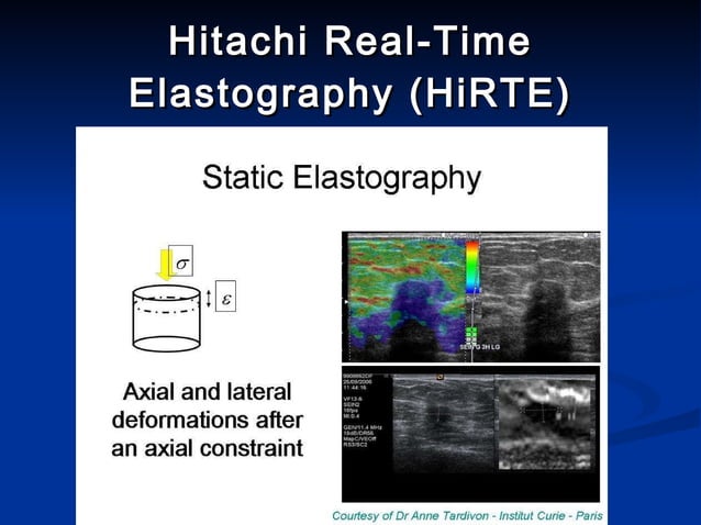 Ultrasound Elastography Medic VN | PPT