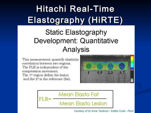 Ultrasound Elastography Medic VN | PPT