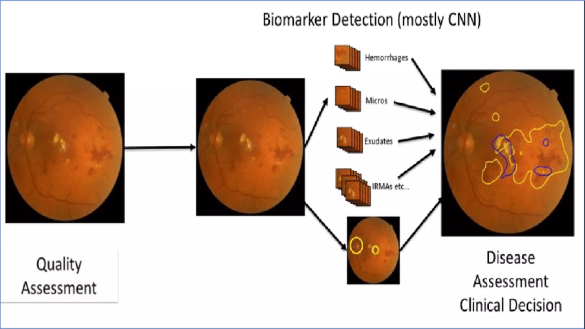 USE OF ARTIFICIAL INTELLIGENCE (DR.MATA SYSTEM) FOR THE DETECTION AND INTERVENTION OF DIABETIC ...