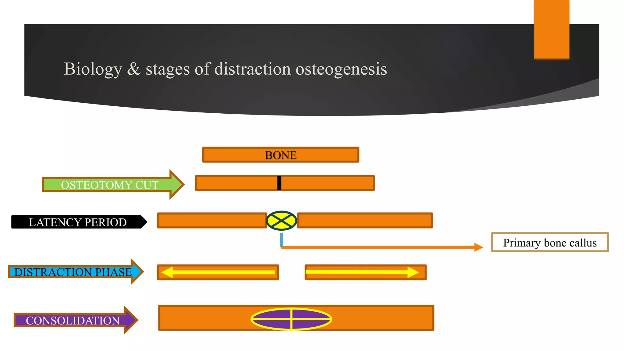 Use of distraction osteogenesis in orthognathic surgery | PPTX