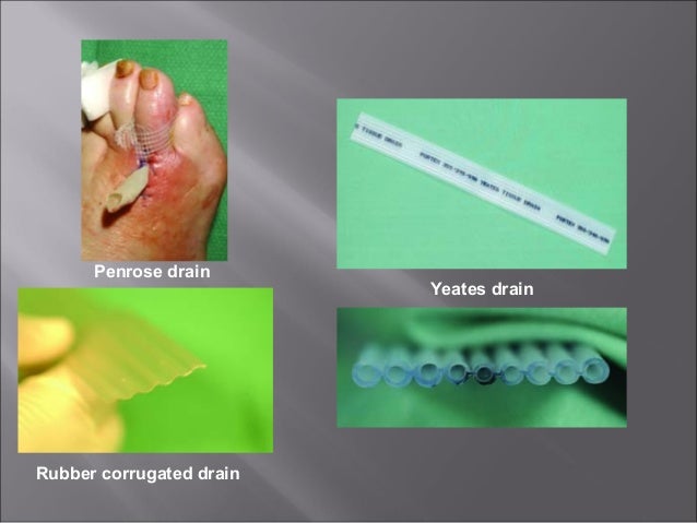 Use of drains in gastrointestinal surgery