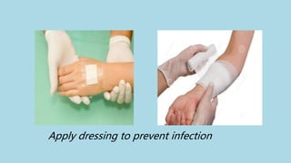 USE OF DRESSING AND BANDAGING.pptx.MSMSM | PPTX