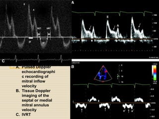 Use of echocardiography in icu | PPTX