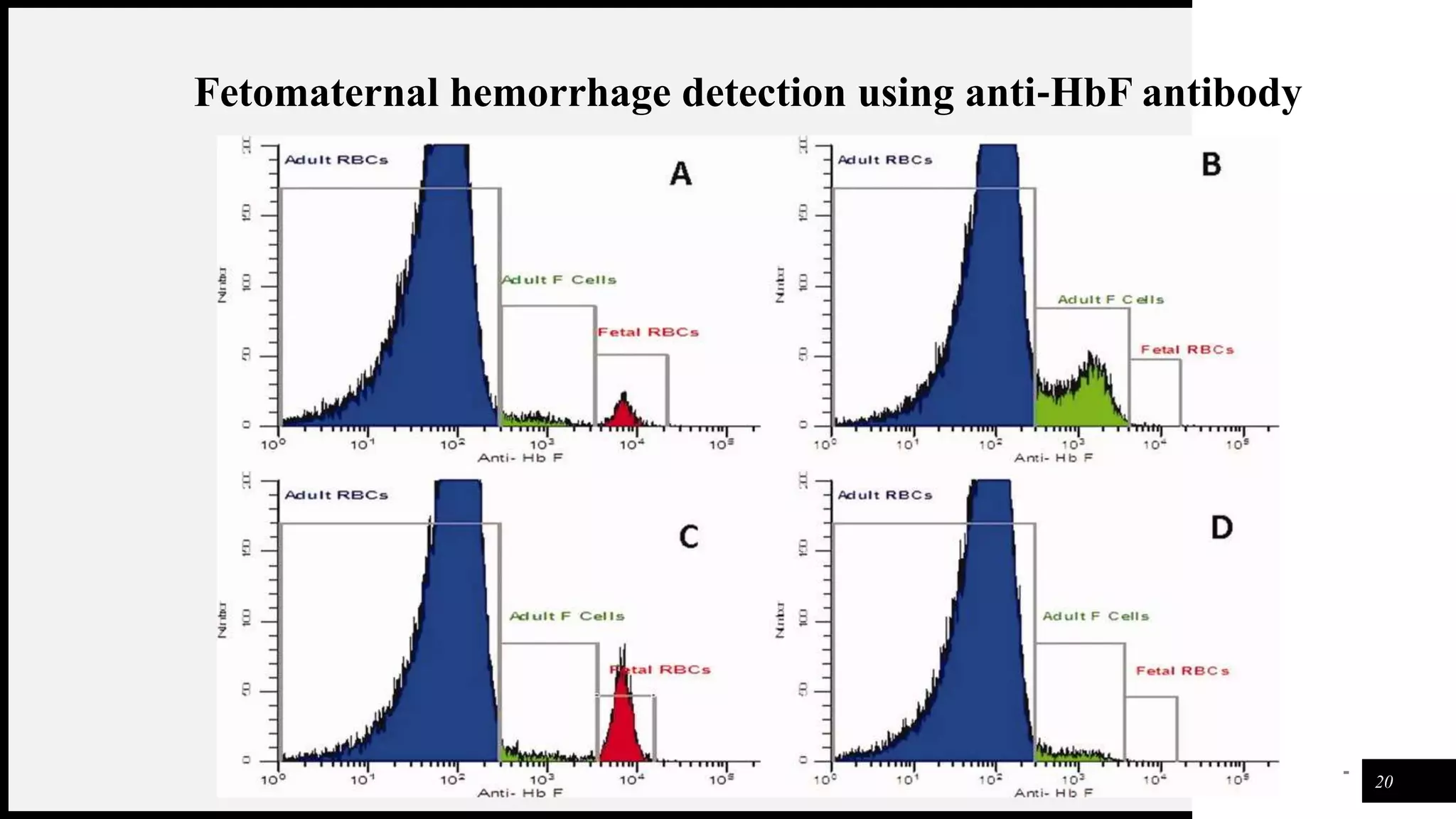 Use of flow cytometry in non neoplastic hematologic conditions | PPTX