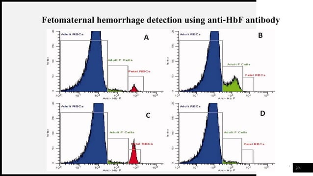 Use of flow cytometry in non neoplastic hematologic conditions | PPTX