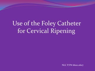 Use of foley catheter for cervical ripening | PPTX
